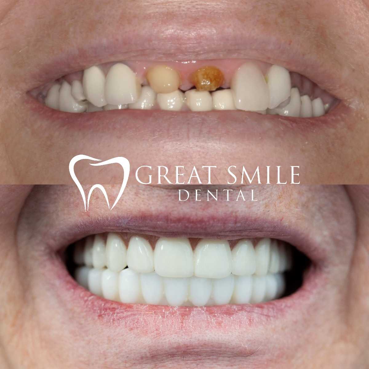 Great Smile Dental